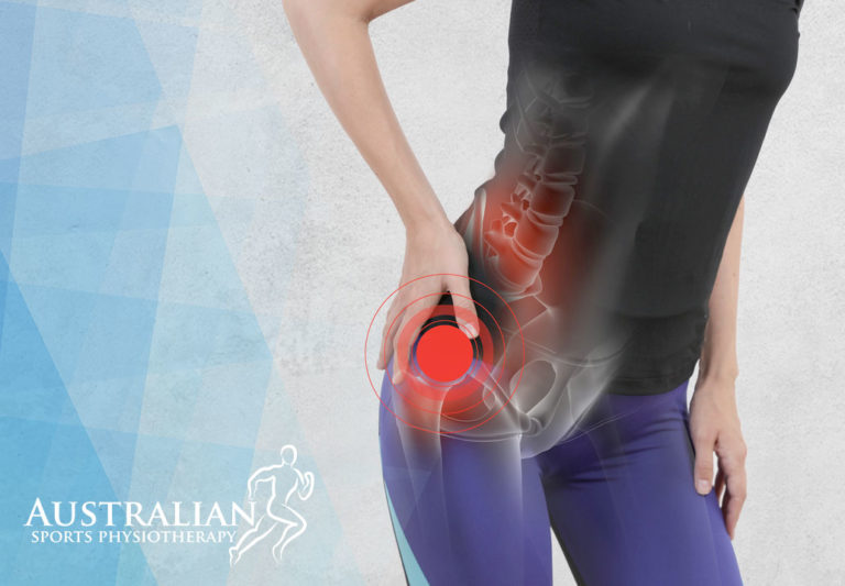Physio Treatment for Snapping Hip Syndrome - Australian Sports ...