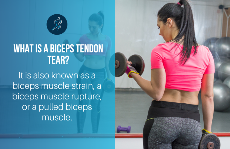 Bicep Tendon Tear Physio | Australian Sports Physiotherapy
