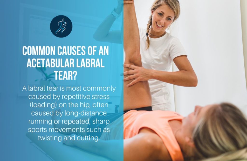 Physio for Acetabular Labral Tears | Melbourne Physio