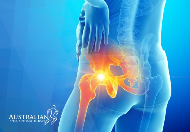Physiotherapy for Snapping Hip | Australian Sports Physio